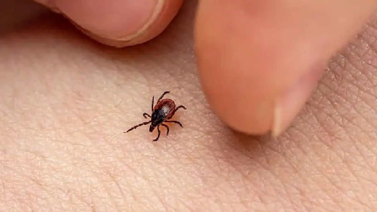 നിപയല്ല; ചികിത്സയിലുള്ള പതിനാലുകാരന് സ്ഥിരീകരിച്ചത് ചെള്ളുപനി | Scrub ...