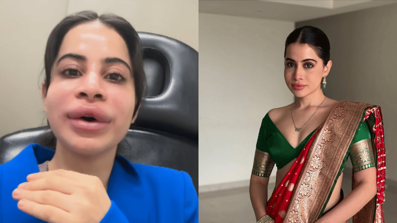 ചുണ്ടുകള്‍ക്ക് വലുപ്പം കൂട്ടാൻ നോക്കി പണിപാളി; മുഖവും ചുണ്ടും വീര്‍ത്ത് വികൃതമായി, വിഡിയോ ...